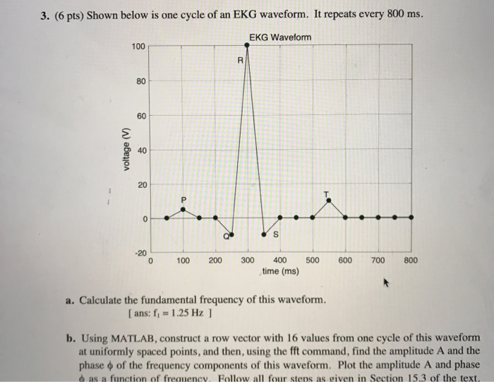 Solved 3. (6 pts) Shown below is one cycle of an EKG | Chegg.com