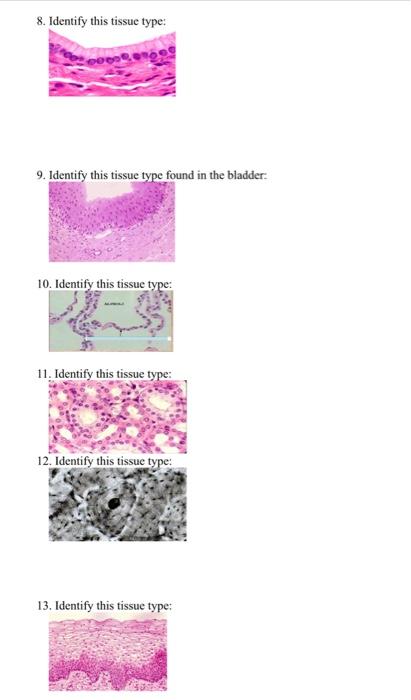 Solved Tissue Identification Worksheet Identify the | Chegg.com