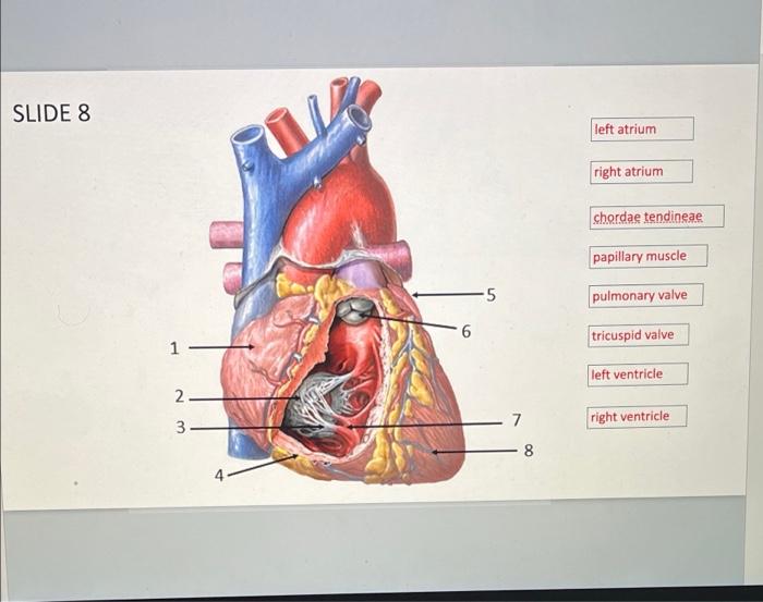 Solved SLIDE 6 left circumflex artery left marginal artery | Chegg.com