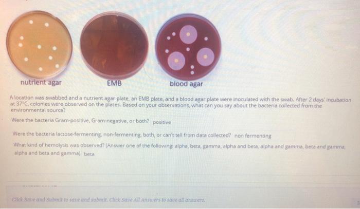Solved nutrient agar EMB blood agar A location was swabbed | Chegg.com