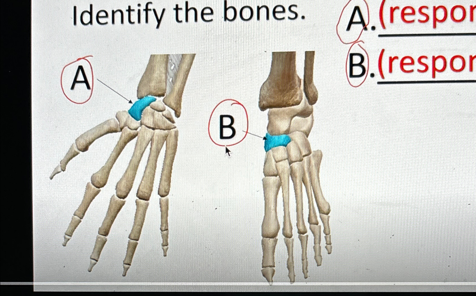 Solved Identify bone A and b | Chegg.com