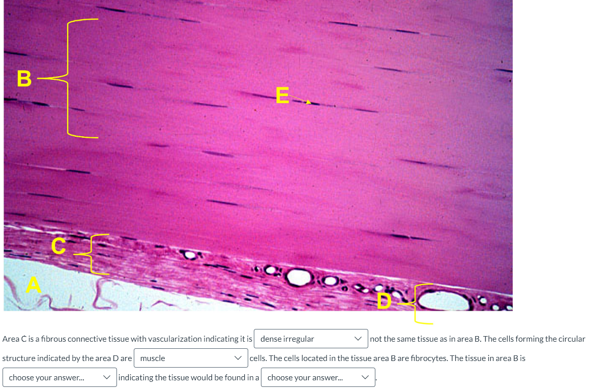 Solved Area C ﻿is a fibrous connective tissue with | Chegg.com