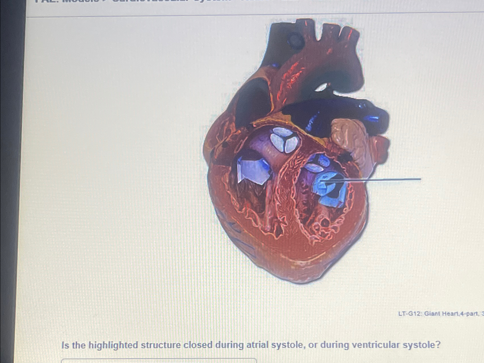 Solved LT-G12: Giant Heart,4-part,Is the highlighted | Chegg.com