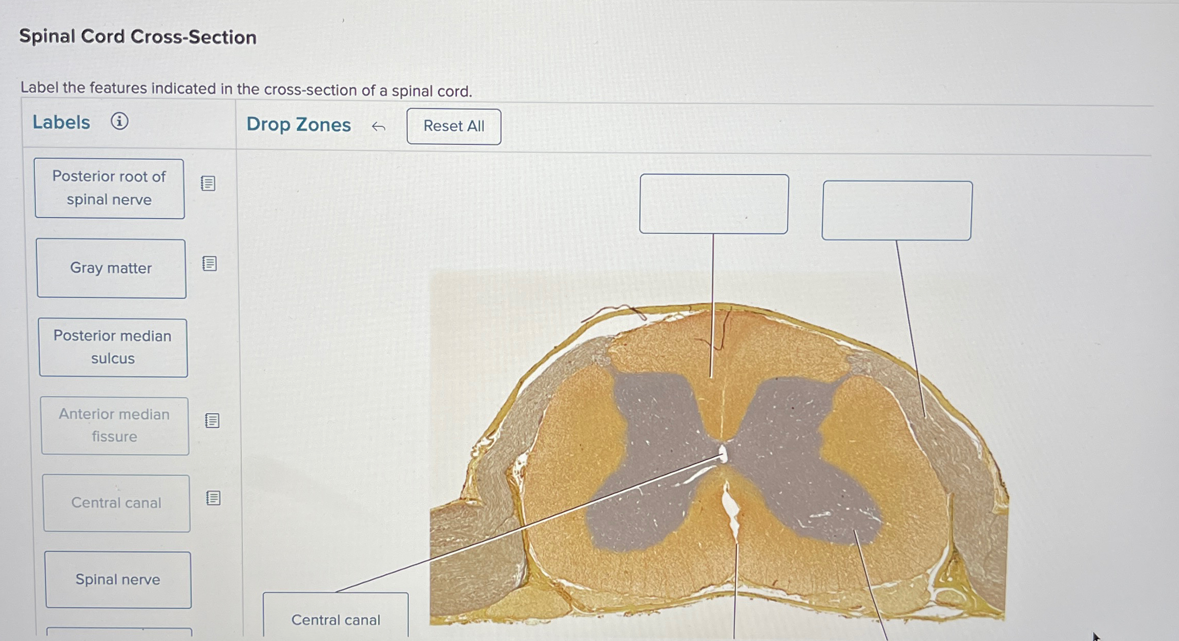 Solved Spinal Cord Cross-SectionLabel the features indicated | Chegg.com
