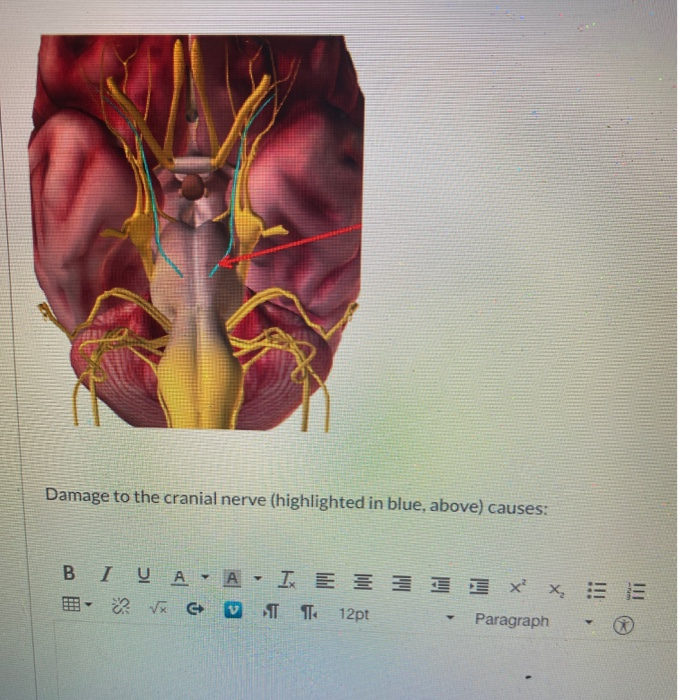 Solved Damage to the cranial nerve (highlighted in blue, | Chegg.com