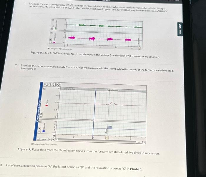 Solved 1 Examine the electromyograpty (EMG) readings in | Chegg.com