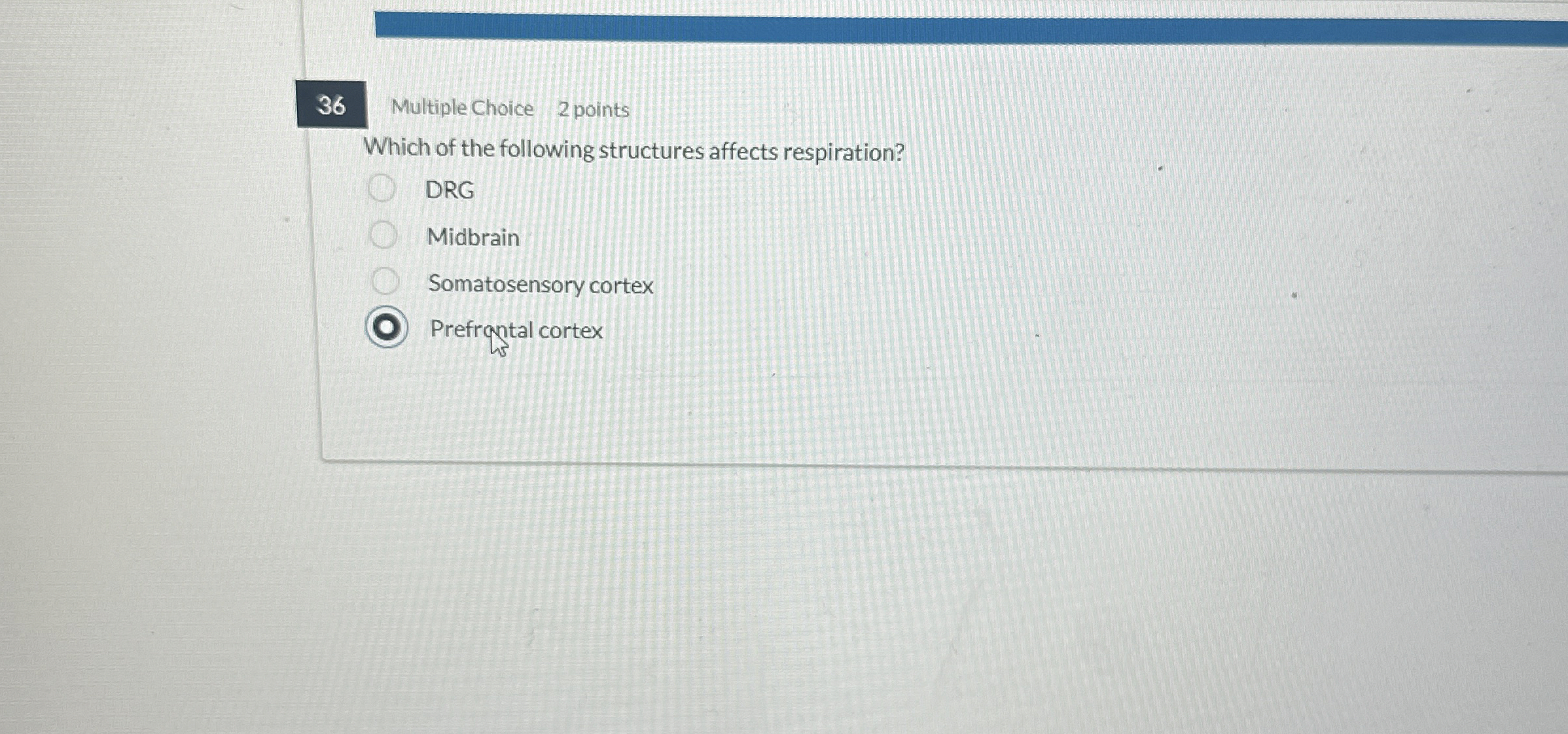 Solved 36 Multiple Choice 2 pointsWhich of the following | Chegg.com Solved 36 Multiple Choice 2 pointsWhich of the following | Chegg.com
