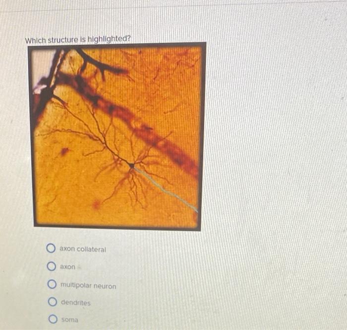 Solved Which structure is highlighted? axon collateral axon | Chegg.com