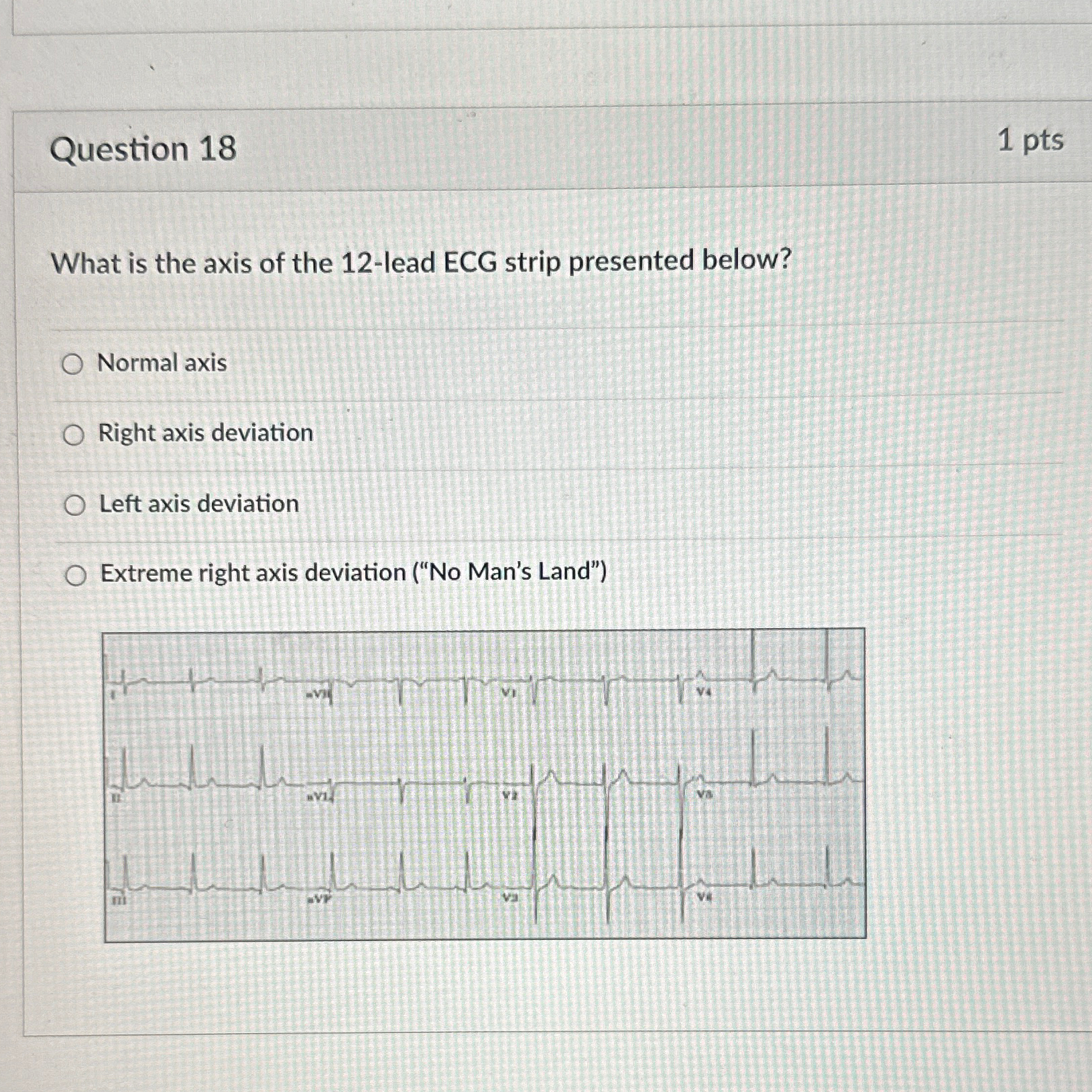 Solved Question 181ptsWhat is the axis of the 12-lead ECG | Chegg.com