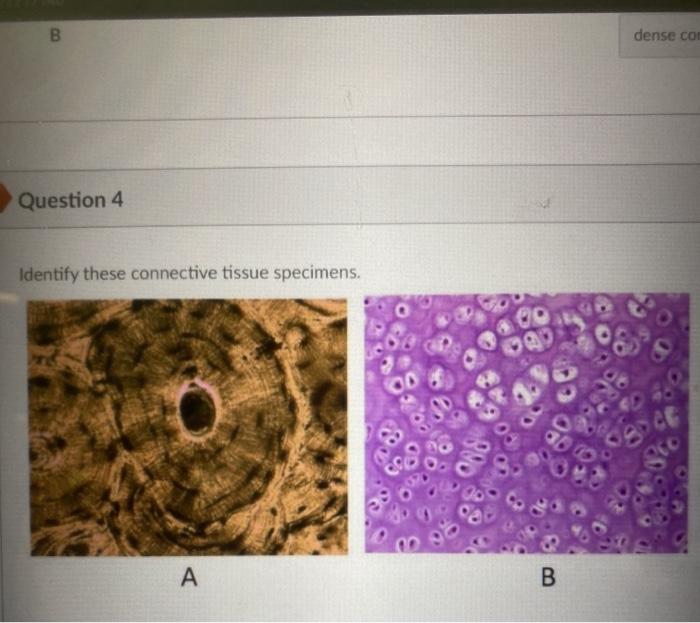 Solved B dense co Question 4 Identify these connective | Chegg.com