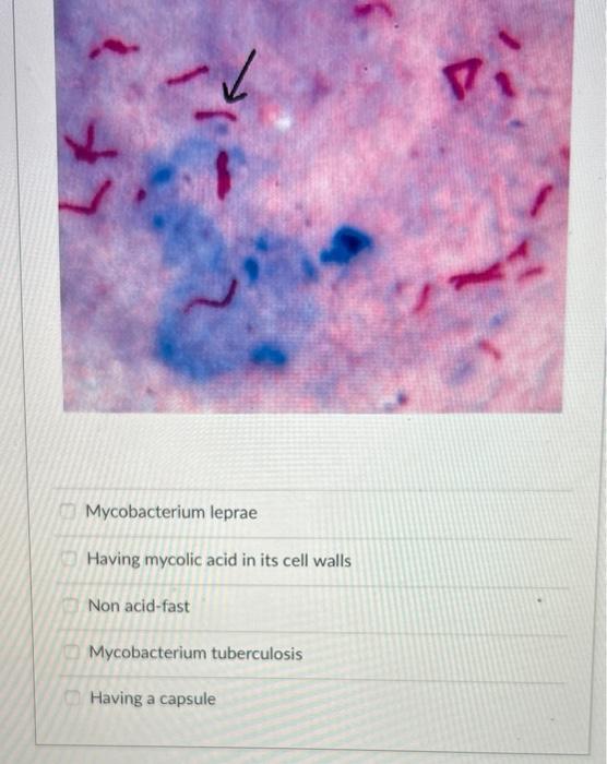 Mycobacterium Leprae Acid Fast
