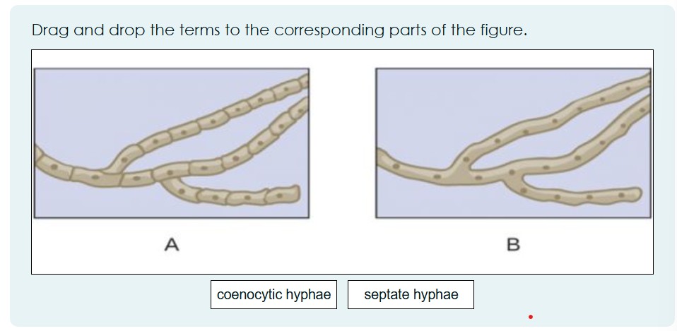 Solved Drag and drop the terms to the corresponding parts of | Chegg.com