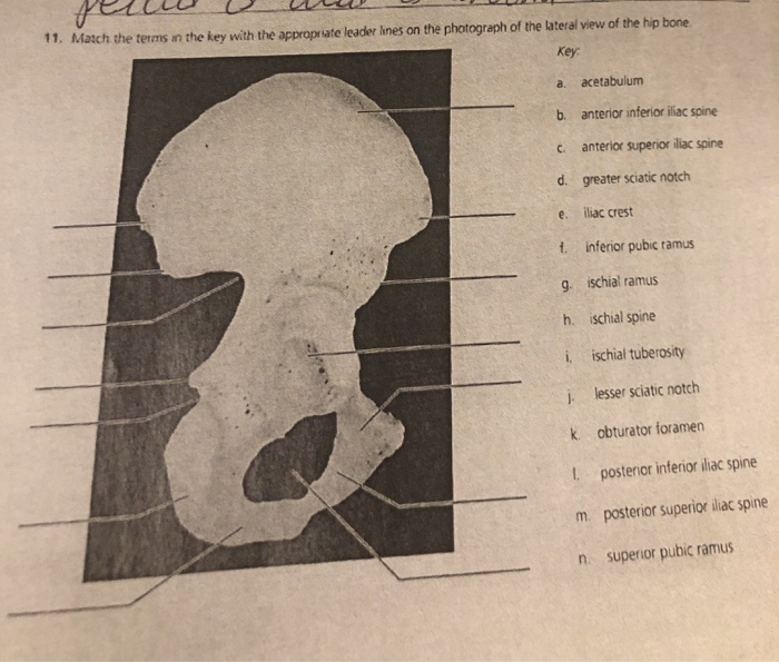 Solved 6. Match the terms in the key with the appropriate | Chegg.com