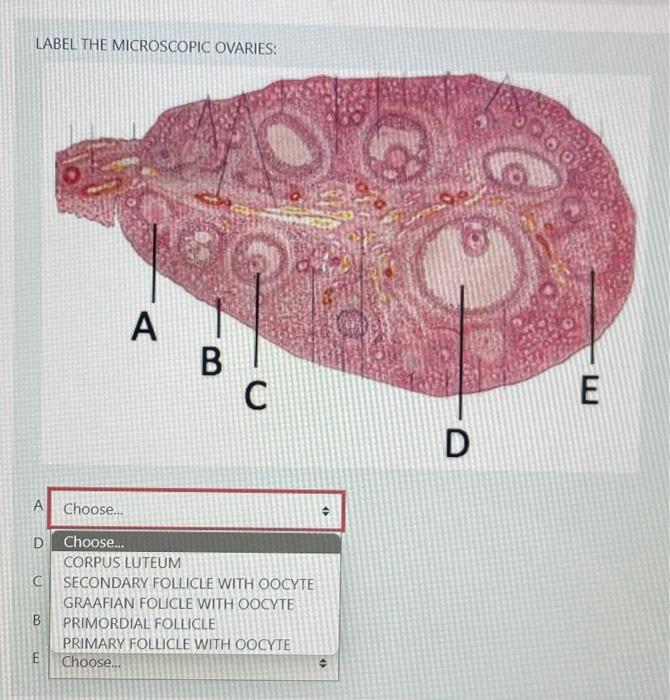 Solved LABEL THE MICROSCOPIC OVARIES: A A B С. E D А | Chegg.com
