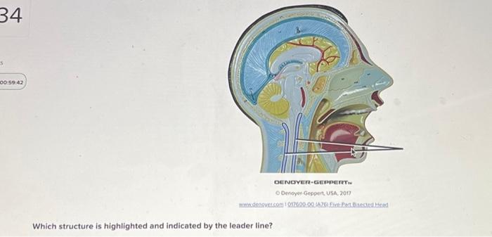 Solved 34 S 00:59:42 1801061 Which structure is highlighted | Chegg.com