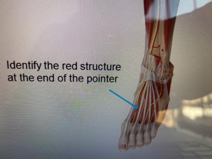 Solved Identify the red structure at the end of the pointer | Chegg.com