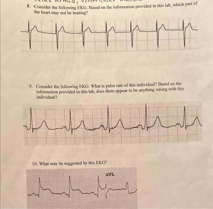 Solved 8. Consider the following EKG. Based on the | Chegg.com