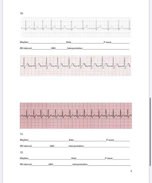 2. Rhythm Rate P wave PR interval QRS Interpretation. | Chegg.com