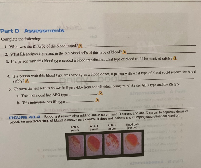 Part D Assessments Complete the following: 1. What | Chegg.com