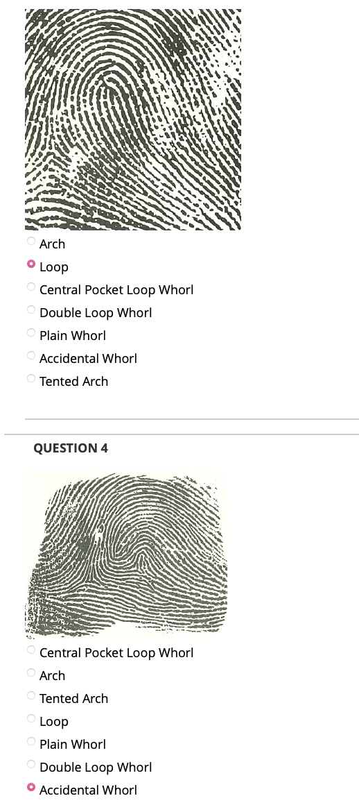 Solved LoopCentral Pocket Loop WhorlDouble Loop WhorlPlain | Chegg.com