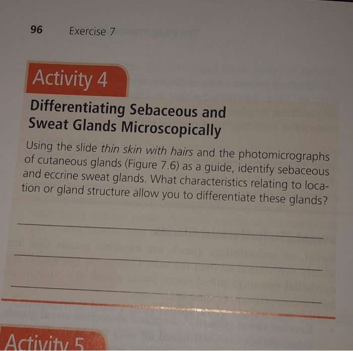 Solved 96 Exercise 7 Activity 4 Differentiating Sebaceous | Chegg.com