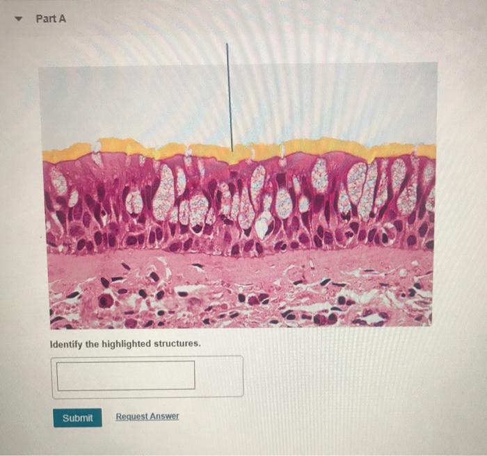 Solved Part A Identify the highlighted structure. striations | Chegg.com