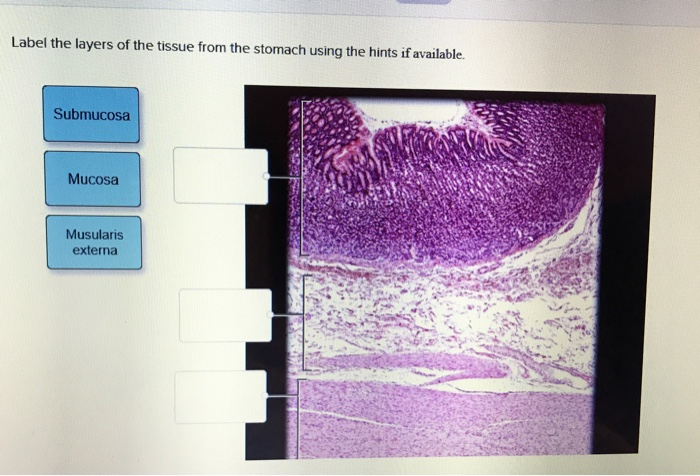 Solved Label the layers of the tissue from the stomach using | Chegg.com