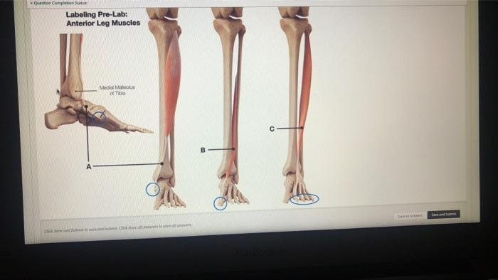 Solved Completion Labeling Pre-Lab: Anterior Leg Muscles | Chegg.com