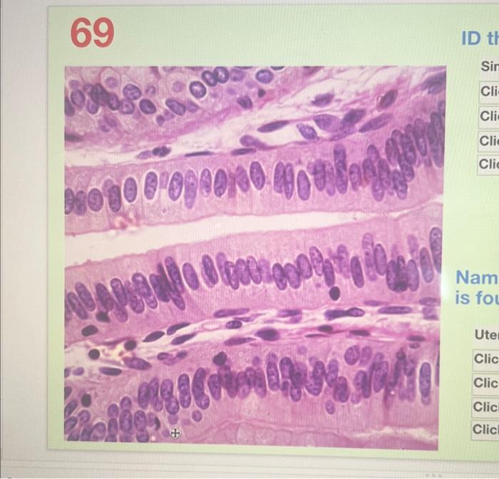 Solved name the tissue ID name 1 location where tissue is | Chegg.com