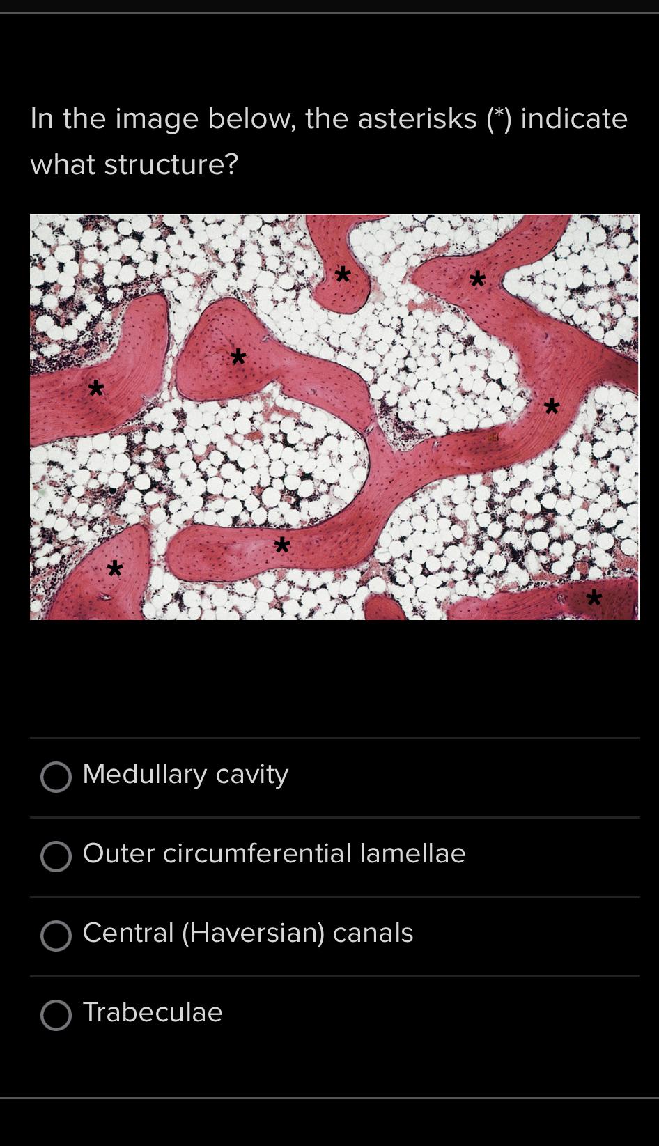 Solved In the image below, the asterisks (*) ﻿indicate what | Chegg.com