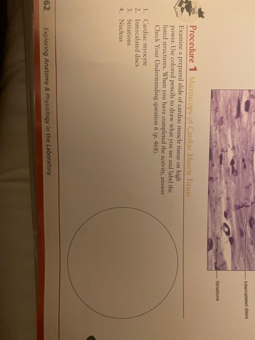 Solved Intercalated disks Striations Procedure 1 Microscopy | Chegg.com