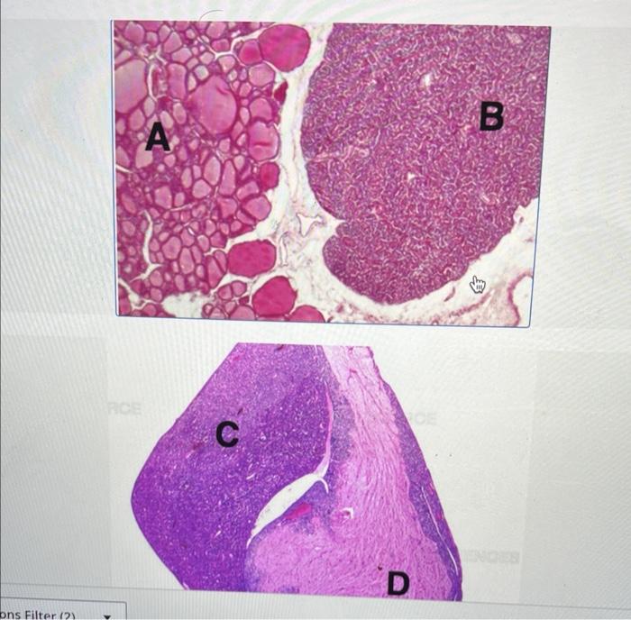 Solved Prompts Submitted Answers Acinar Cells B Adrenal 