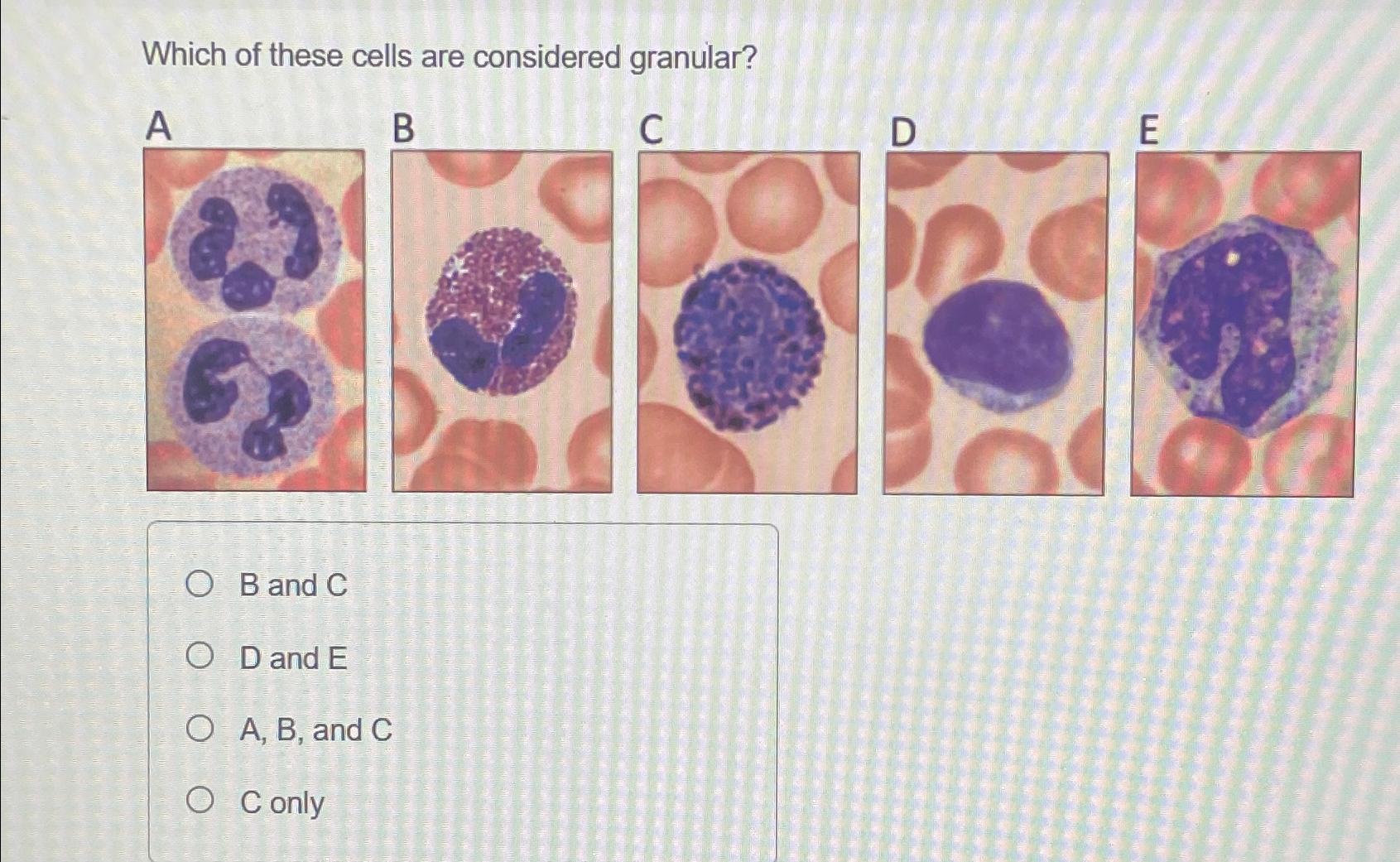 Solved Which of these cells are considered granular?ABcDEB | Chegg.com