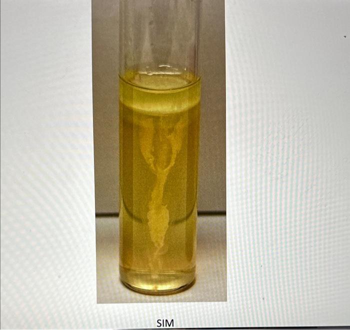 Solved List the various results of the SIM Agar (unknown | Chegg.com
