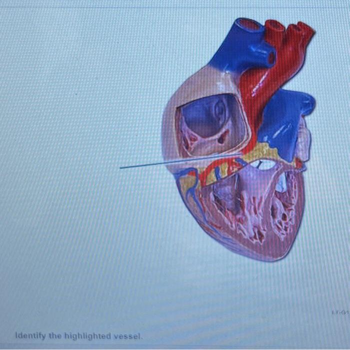Solved Identify the highlighted vessel. | Chegg.com
