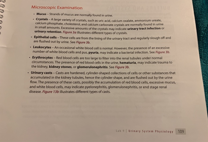 Microscopic Examination . Mucus - Strands of mucus | Chegg.com