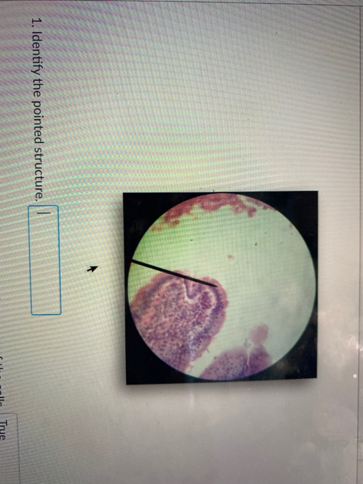 Solved 1. Identify the pointed structure. True | Chegg.com