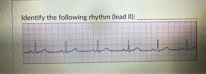 Solved Identify the following rhythm (lead II): | Chegg.com