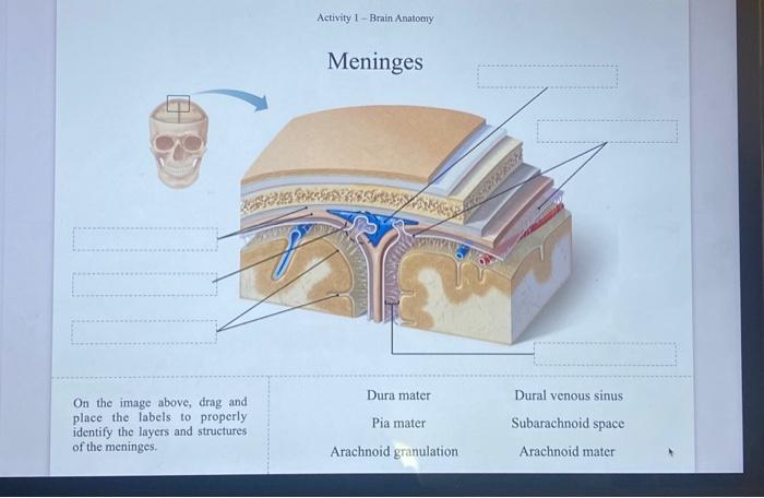 Solved Activity 1 - Brain Anatomy Meninges | Chegg.com