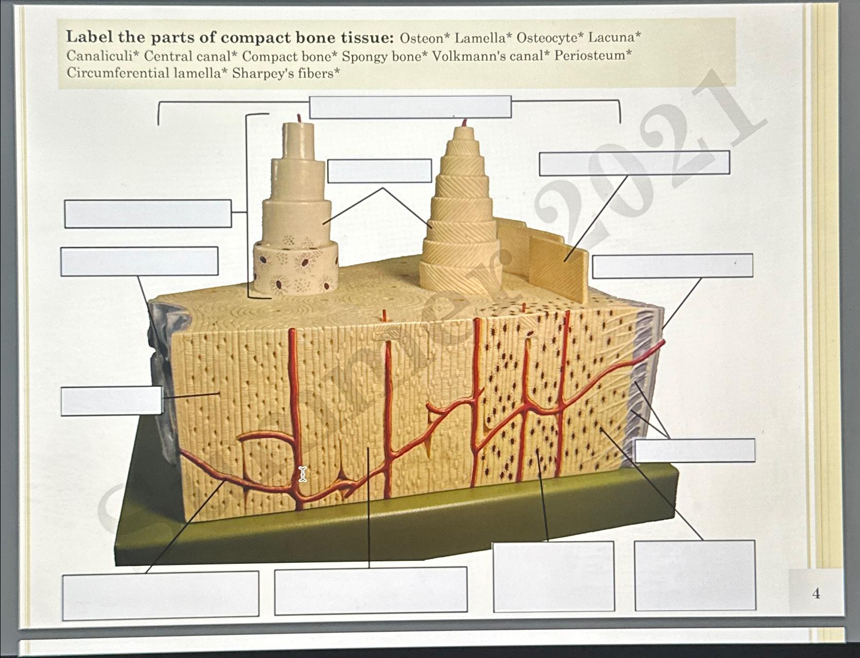 Solved Label the parts of compact bone tissue: Osteon* | Chegg.com