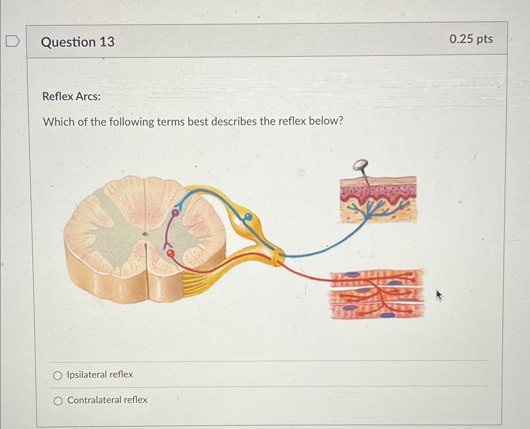 Solved Question 130.25 ﻿ptsReflex Arcs:Which of the | Chegg.com