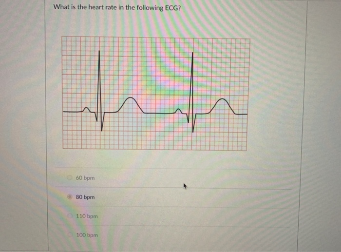 Solved What is the heart rate in the following ECG? 나 60 bpm | Chegg.com