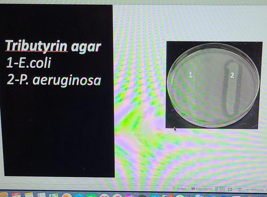 Solved Starch Agar-Looking at the results presentation | Chegg.com