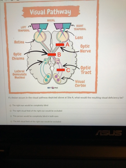 Solved Visual Pathway NASAL LEFT RIGHT TEMPORAL TEMPORAL | Chegg.com