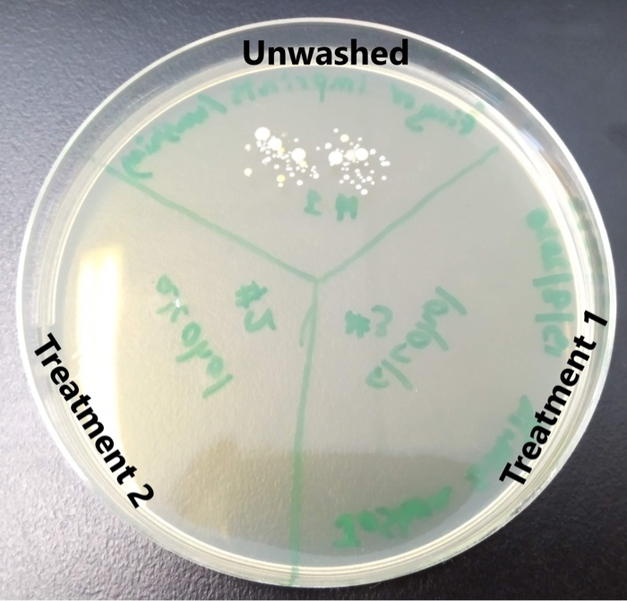 Solved Microflora of the Human Skin: Hand HygienePresent a | Chegg.com
