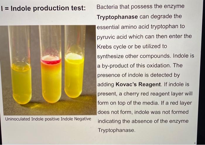Solved Experiment 33 IMVIC Test The IMVIC series of tests is | Chegg.com