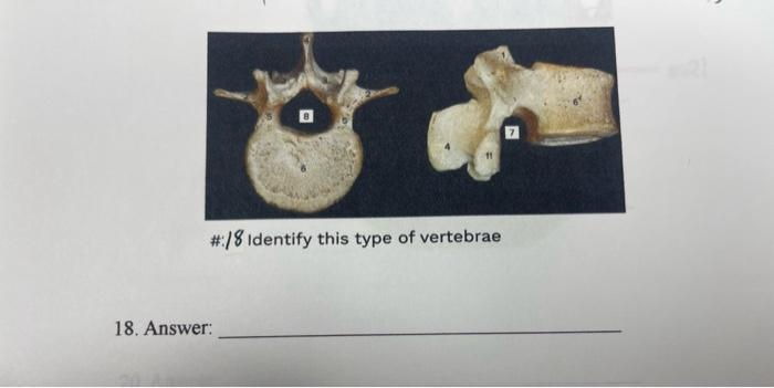 Solved #:18 Identify this type of vertebrae | Chegg.com