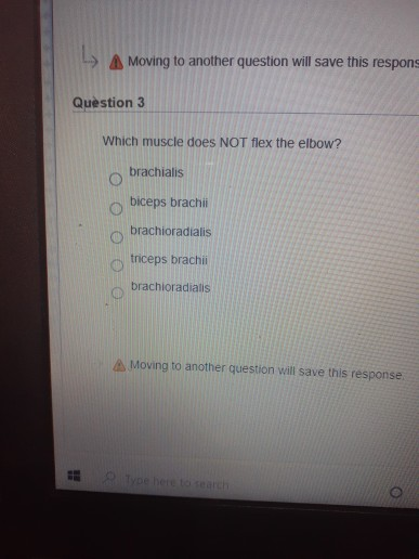 Solved Moving to another question will save this respons | Chegg.com