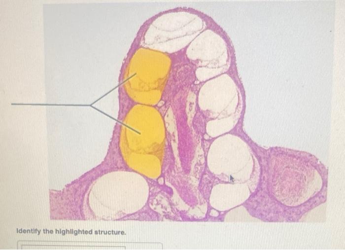 Solved Identify the highlighted structure. | Chegg.com