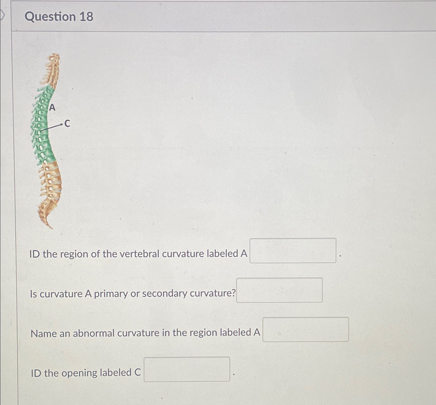 Solved Question 18ID the region of the vertebral curvature | Chegg.com